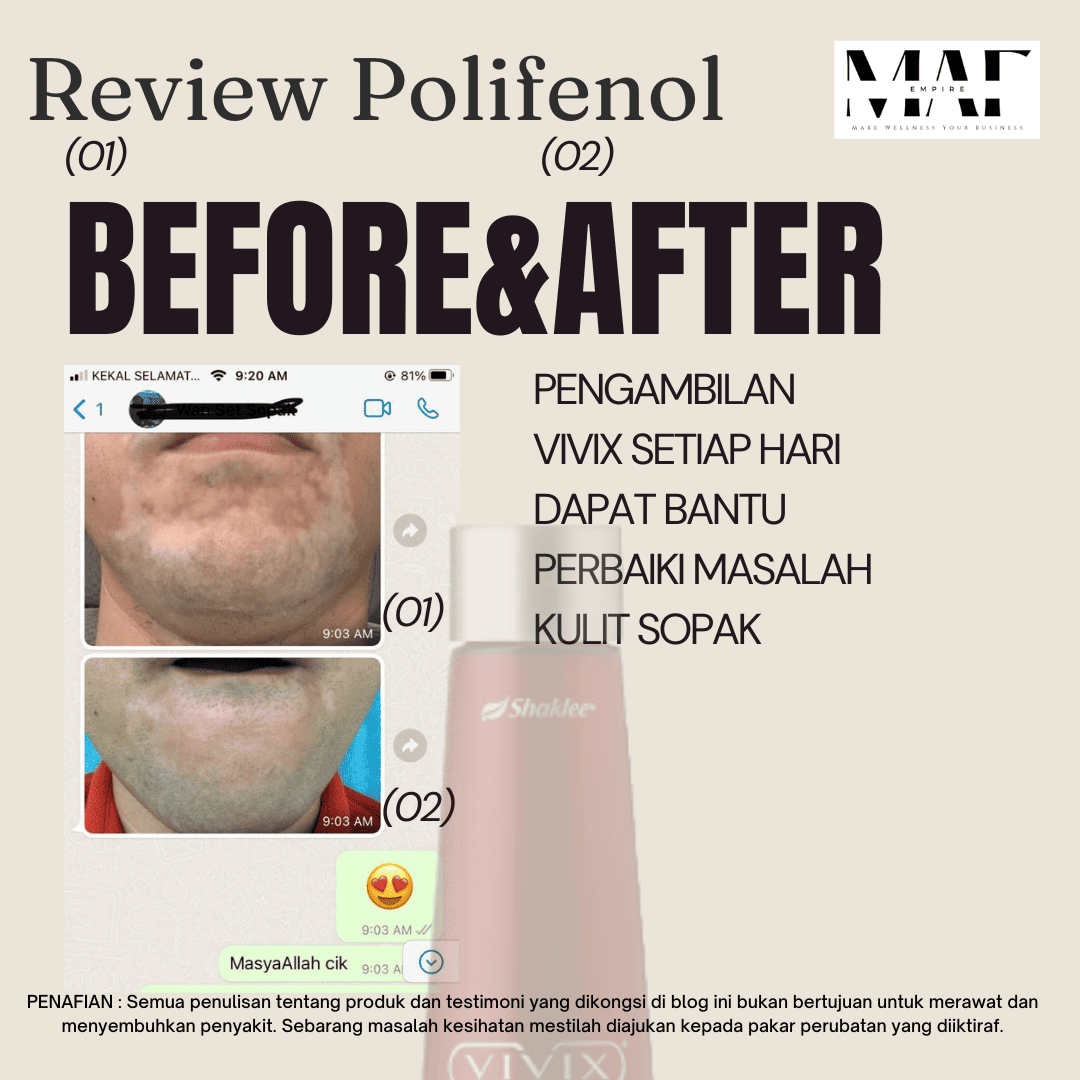 Vivix Bantu Perbaiki Kulit Sopak